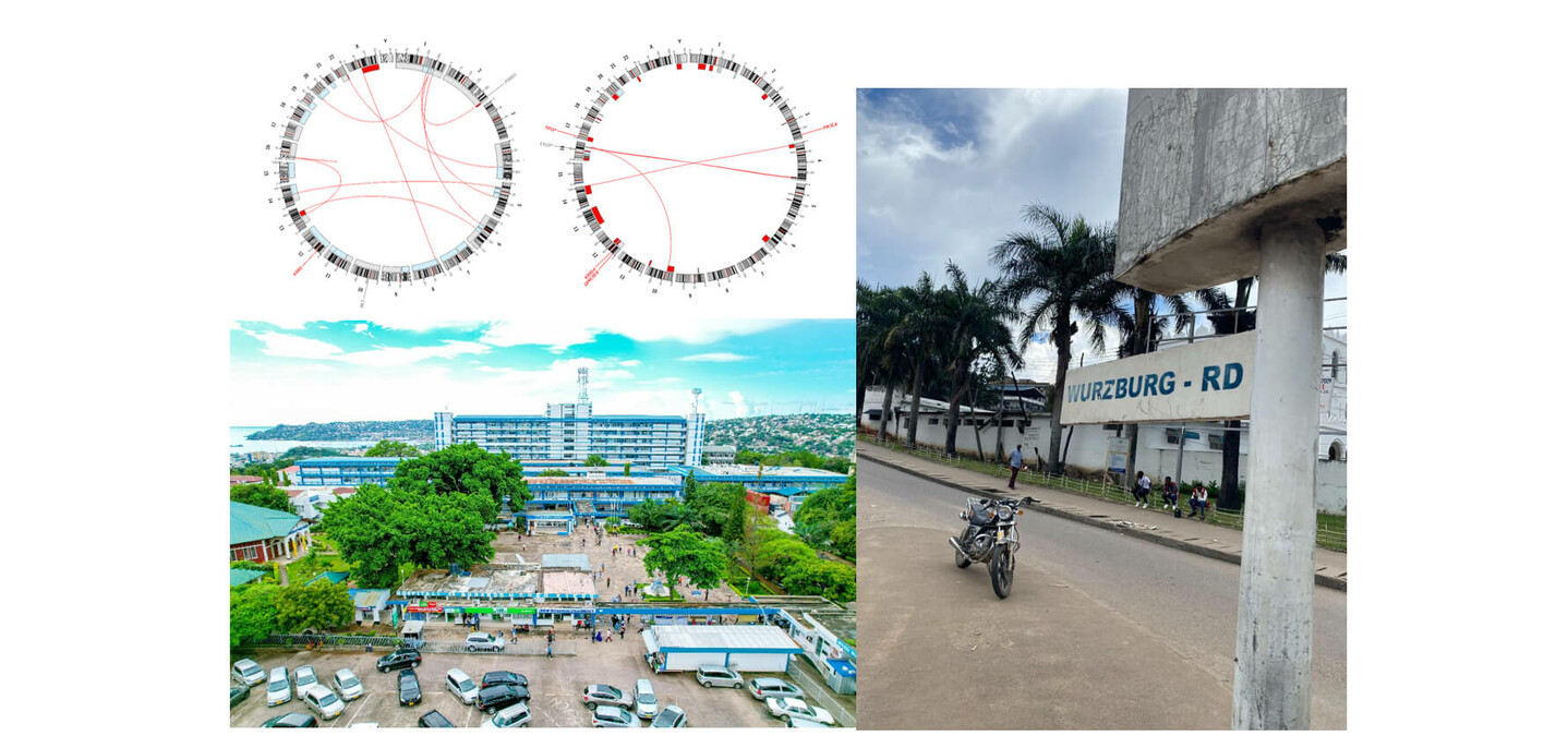 Erste Einblicke in die Tumorbiologie des Myeloms in Afrika mithilfe von ...